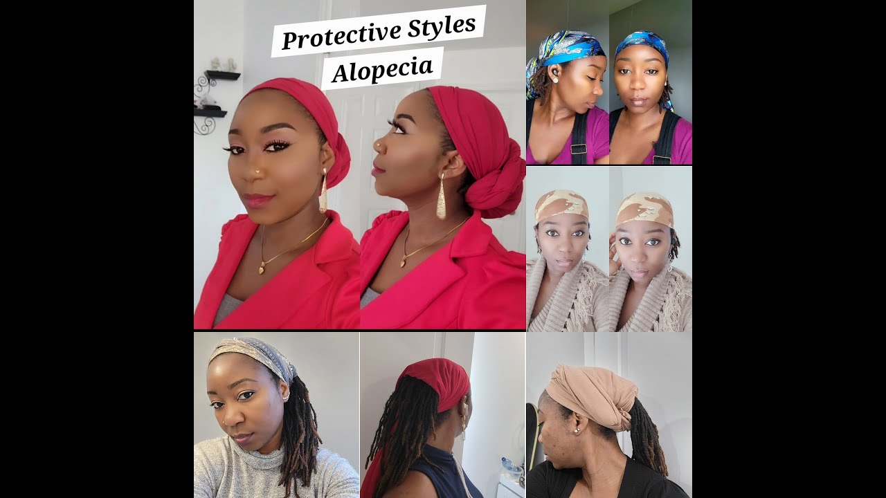 How I Rock My Locs and Conceal Alopecia with Scarves & Headbands ...