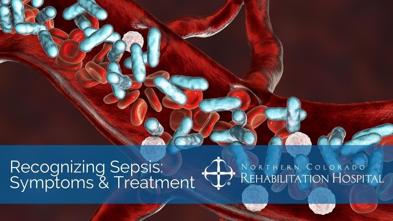 Recognizing Sepsis: Symptoms & Treatment | Northern Colorado ...
