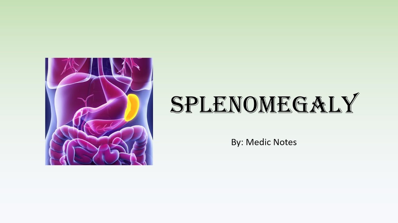 Splenomegaly - causes, pathophysiology, differential diagnoses - YouTube