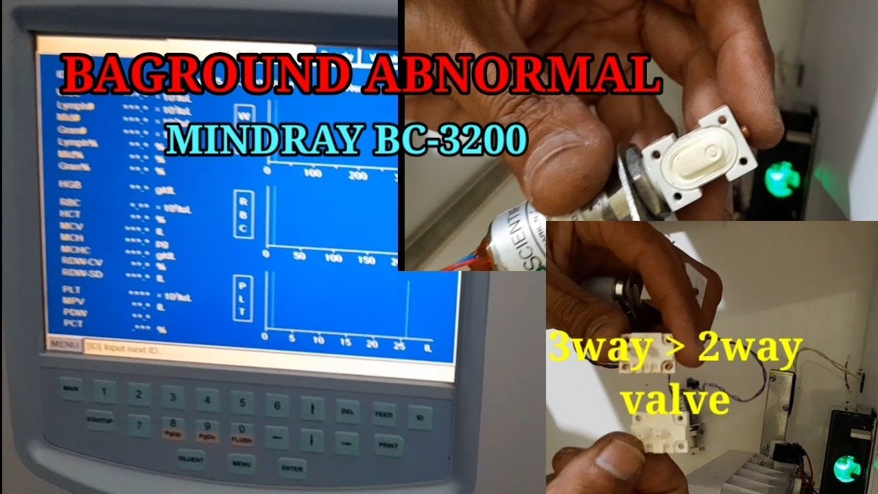 Hematologi mindray BC-3200 - YouTube