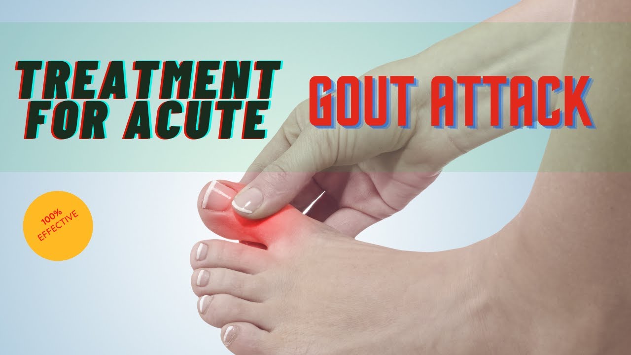 Gout Pain - Treatment For Acute Gout Attack| Natural Health Tips ...