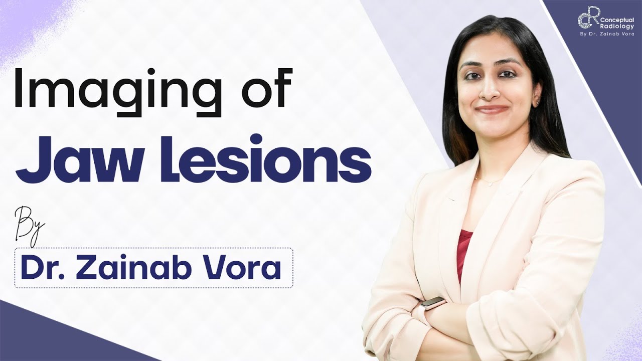 Imaging of Jaw lesions by Dr Zainab Vora - YouTube