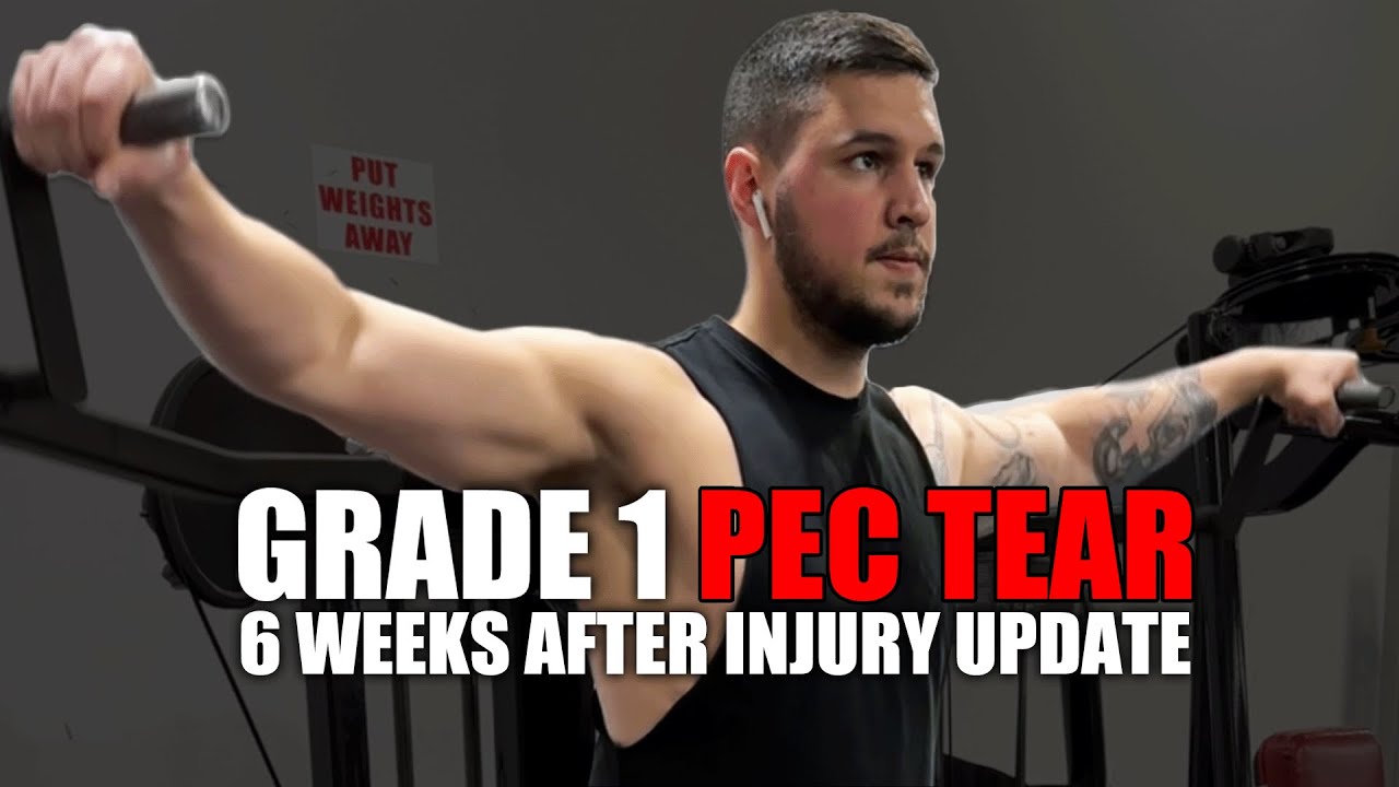 Pec Tear Update (6 Weeks After Injury) - YouTube
