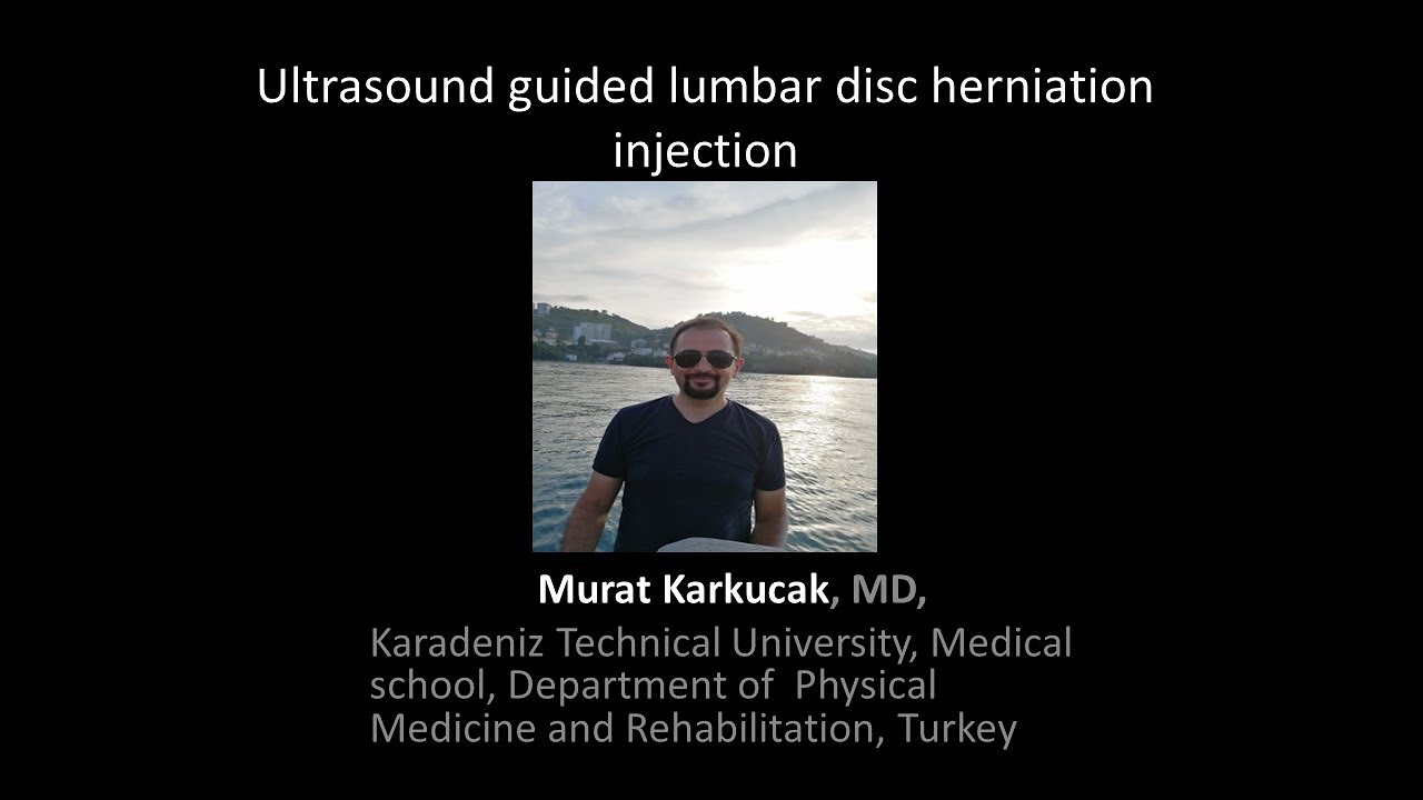 Ultrasound guided lumbar disc herniation injection - YouTube