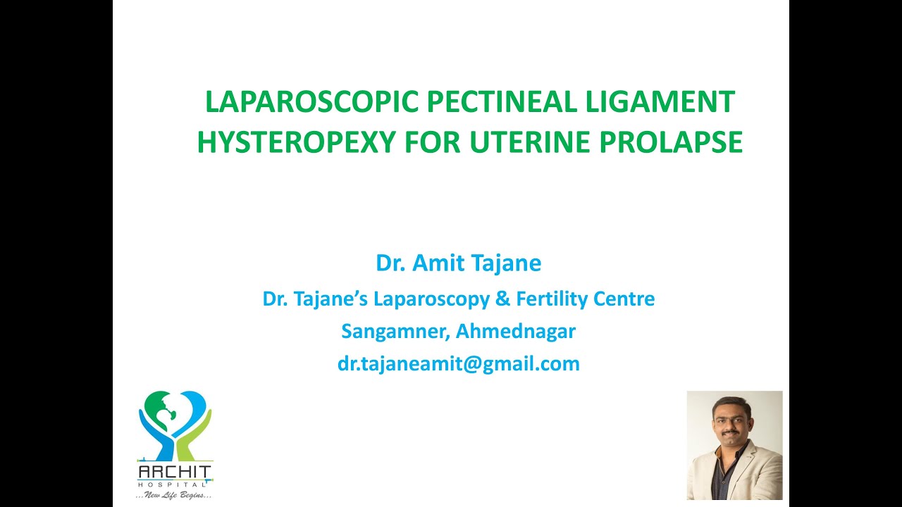 Laparoscopic Pectineal Ligament Hysteropexy Pectopexy Iage Endoscopy