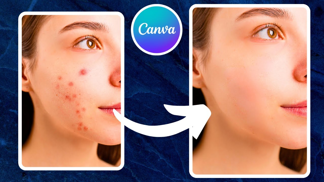 Easy Acne Removal Tutorial using canva | Canva ai - YouTube