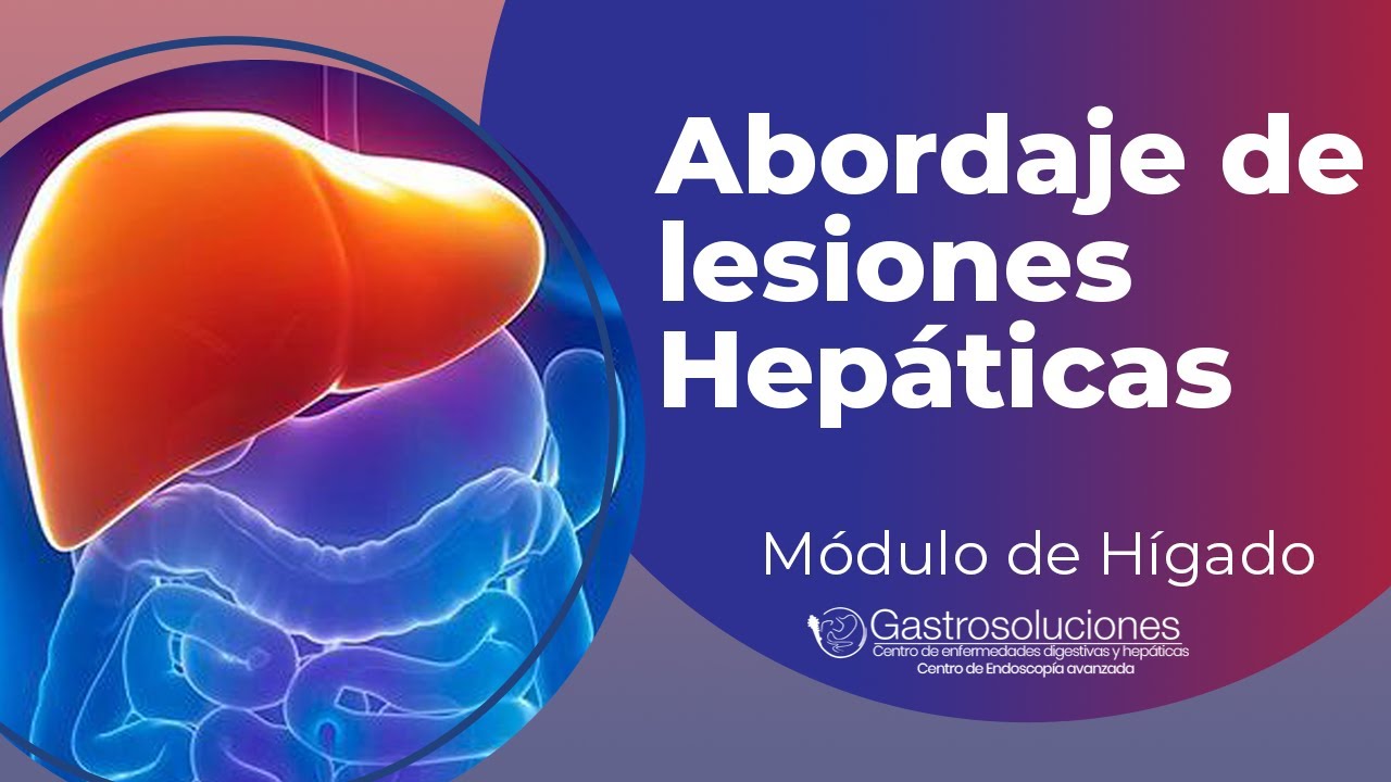 Abordaje de lesiones hepáticas. Dr. Ignacio García - YouTube