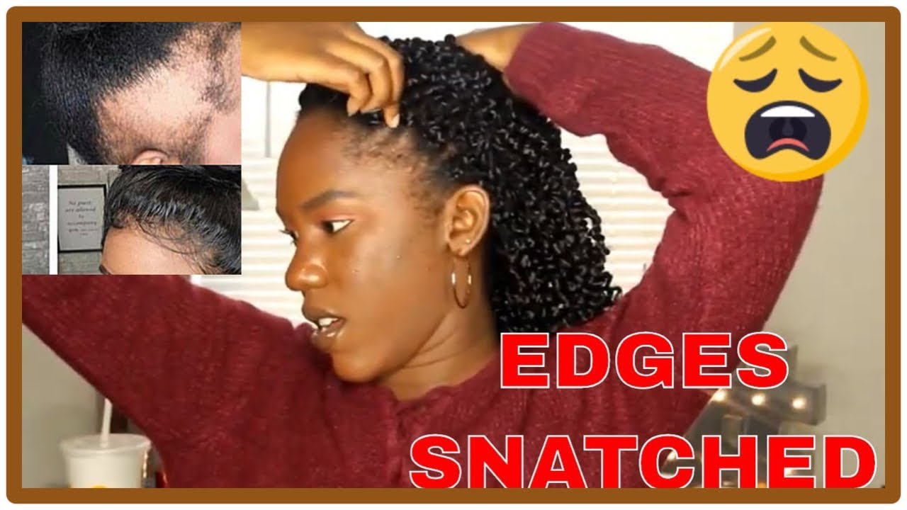 The Day my edges were SNATCHED!! | Tips on Growing Back Edges QUICKLY ...