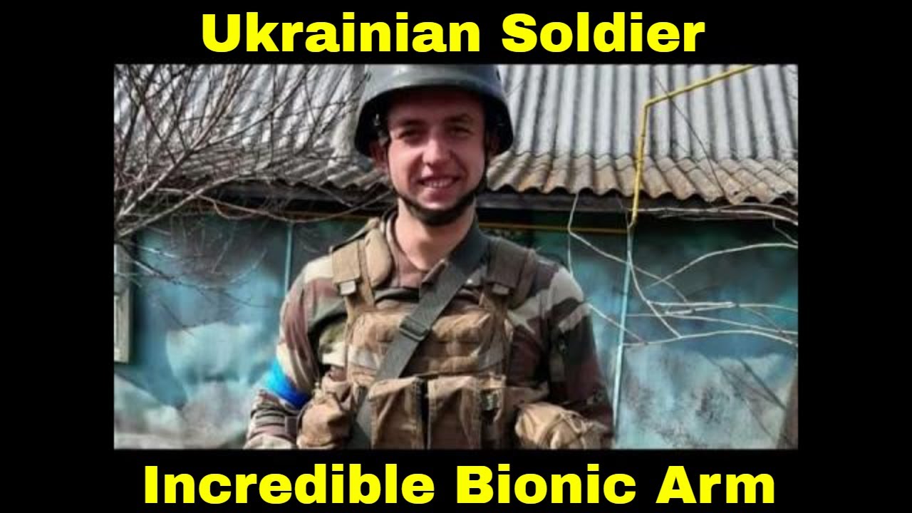 Incredible Ukrainian Soldier's Bionic Arm - YouTube