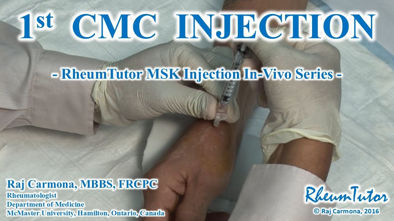1st CMC INJECTION - In-Vivo Series - YouTube