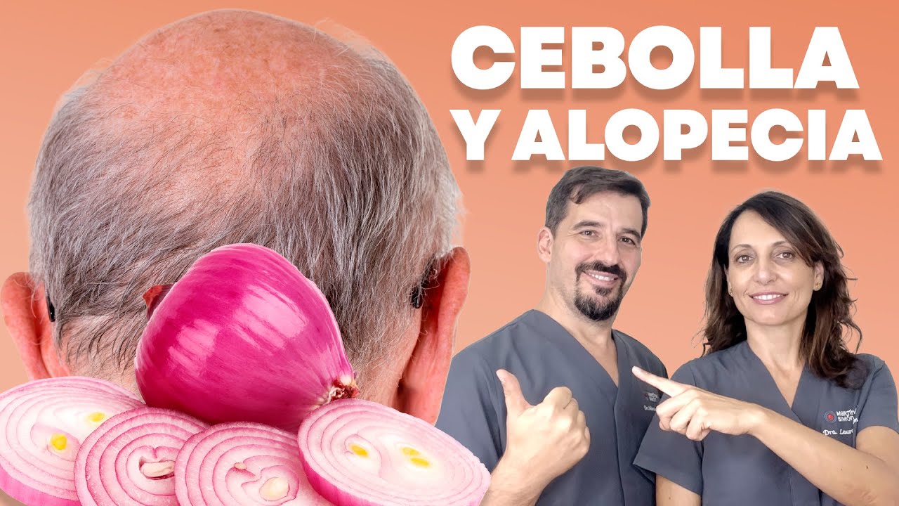 🔴 Cómo Preparar y Utilizar Cebolla para el Cabello 🧅 - YouTube