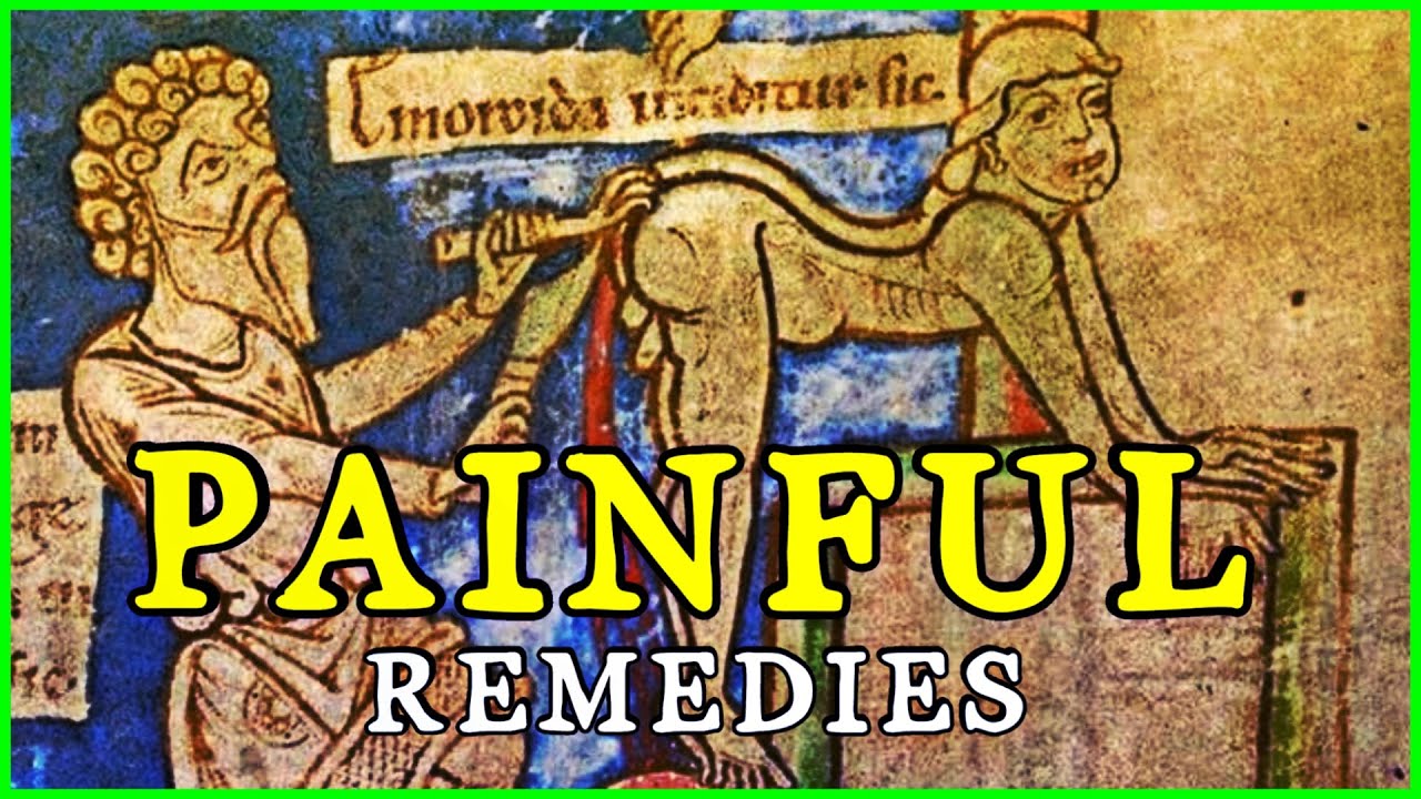 Top 5 Most PAINFUL Medieval Surgical & Medical Treatments! - YouTube