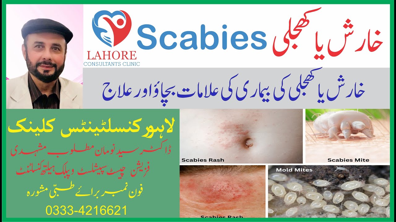 28. Understanding Scabies: Symptoms, Treatment, and Prevention | Expert ...
