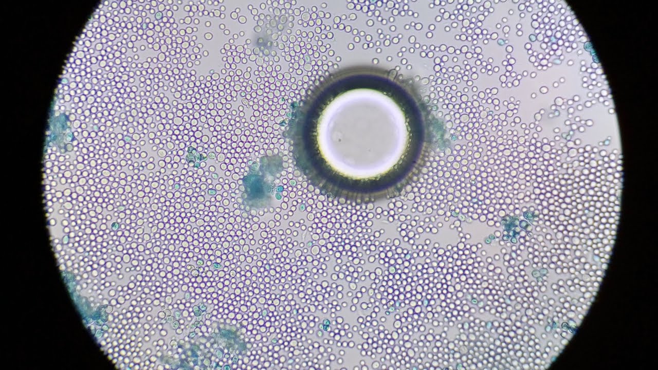 CO2 Bubble From Yeast #saccharomyces #carbondioxide #microscopy - YouTube