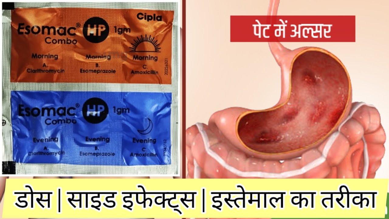 Esomac HP Kit Tablet Uses | Side Effect in Hindi Amoxycillin ...