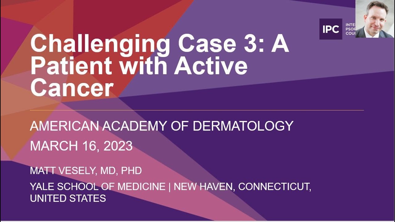 Challenging Case 3: A Patient with Active Cancer | Matt Vesely, MD, PhD ...