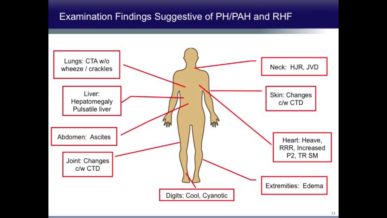 Pulmonary Arterial Hypertension Diagnosis, Classifications and Therapy ...