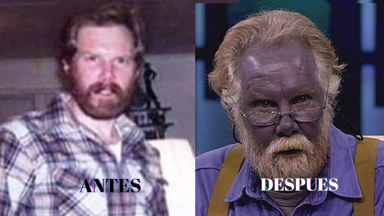 COSAS QUE NO SABIAS /Síndrome de la piel azul - YouTube