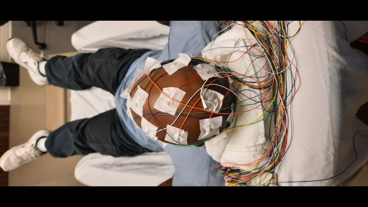 MIGRAINE Transient Aphasia Episode02 - YouTube