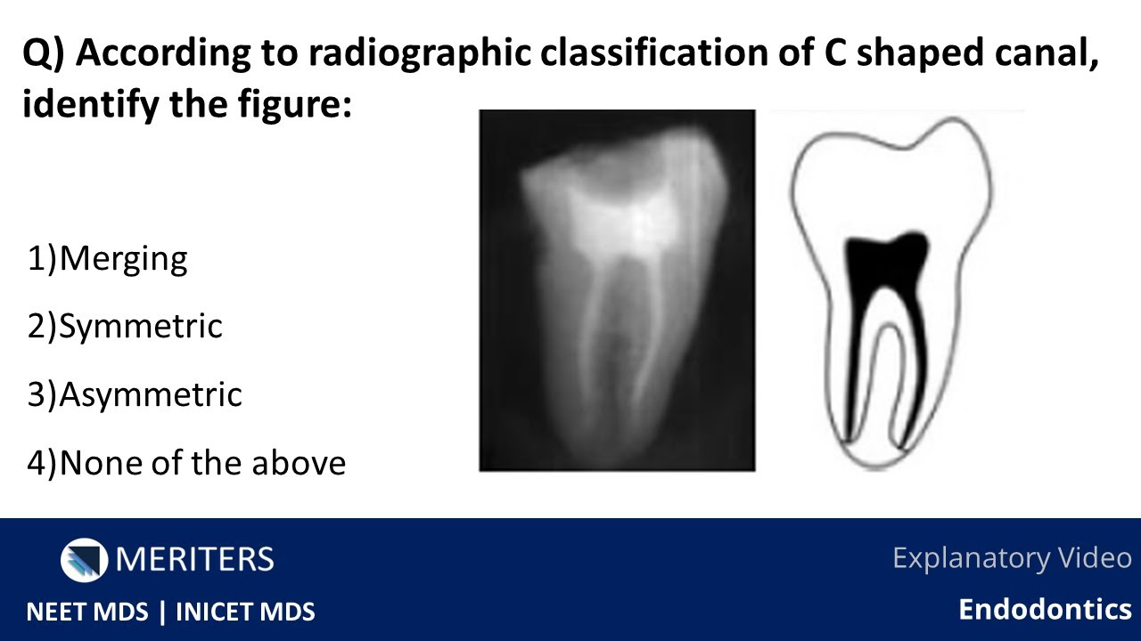 NEET MDS | INICET - Anatomy Of The Pulp Cavity | Explanatory Video ...