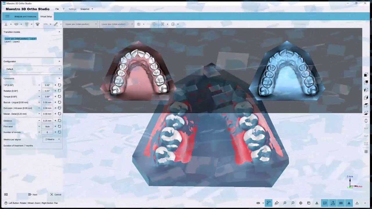 Maestro3D Dental Studio Ortho Studio V5 - YouTube
