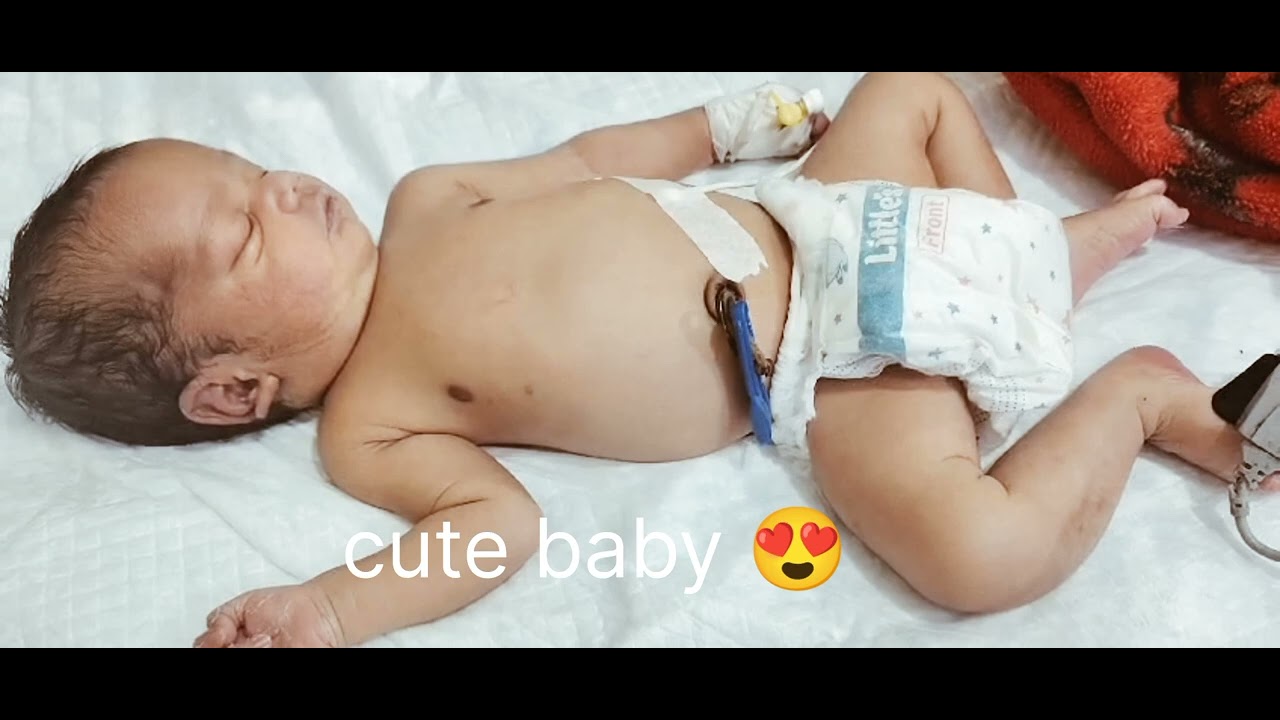 New born another female baby came delivred with lscs baby is very good ...
