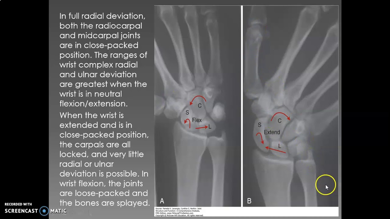 Biomechanics wrist and hand complex, Part 7, Prof Nishand, AWH Special ...