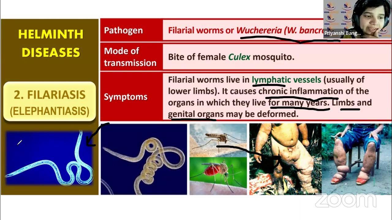 Infectious diseases | Human health and diseases | L1 | Class 12 ...