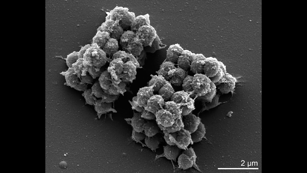 Micrococcus Sedentarius ; Definition, Morphology, Habitat ...