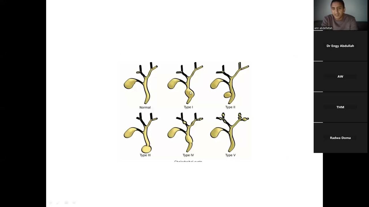 GIT spotting lecture 2 part 1 - YouTube