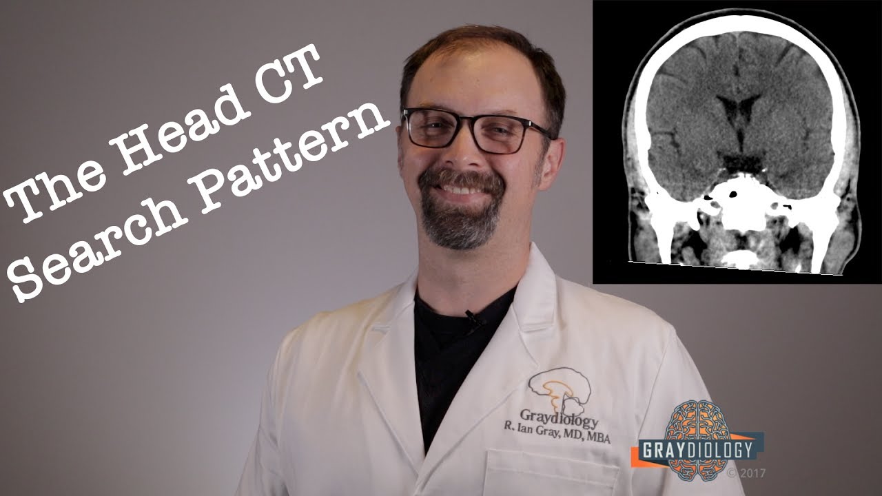 How to Look at a Head CT - YouTube