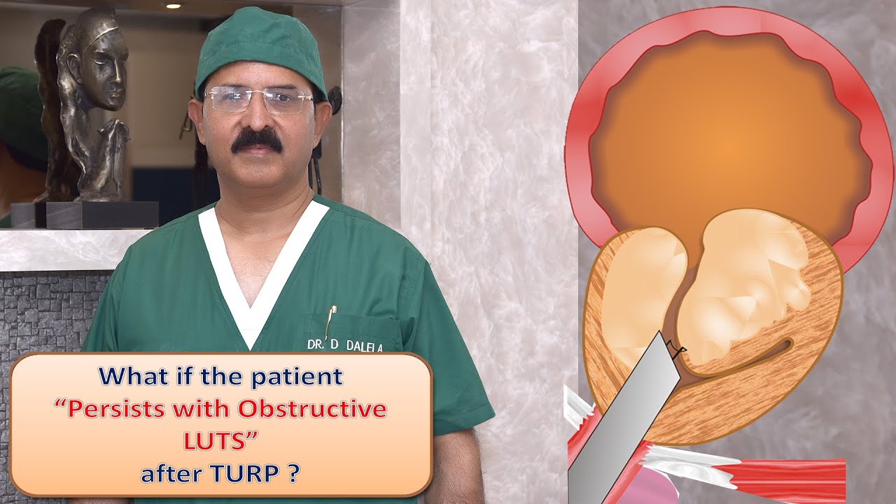 what if the patient persists with obstructive LUTS after TURP - YouTube