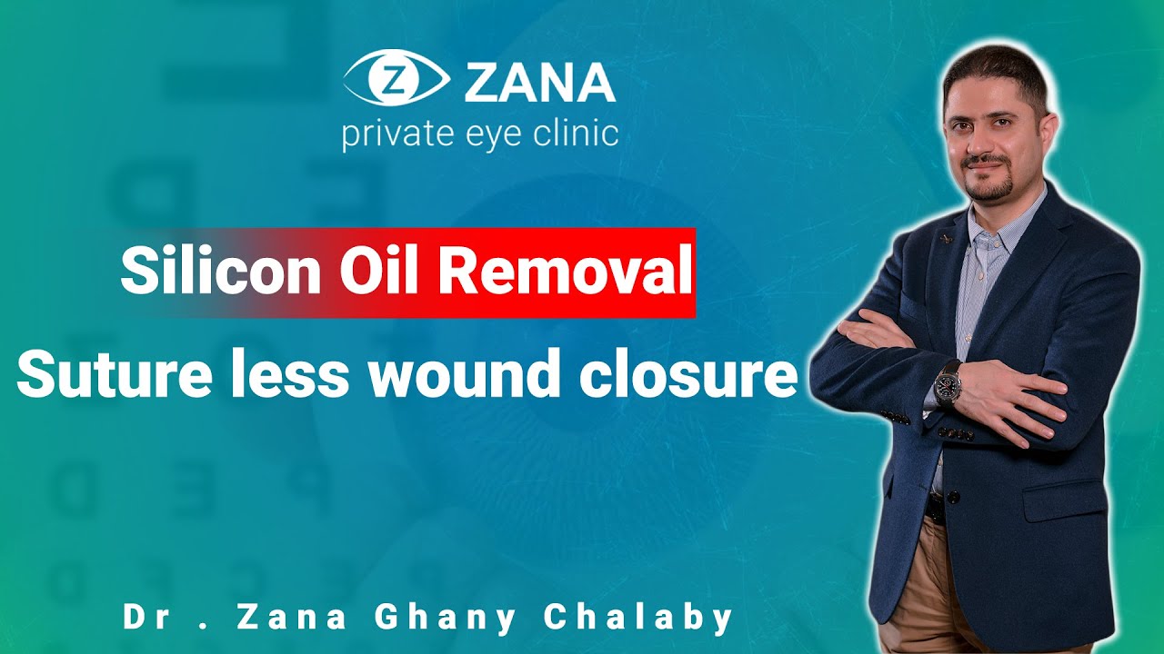 Silicon Oil Removal Suture less wound closure - YouTube