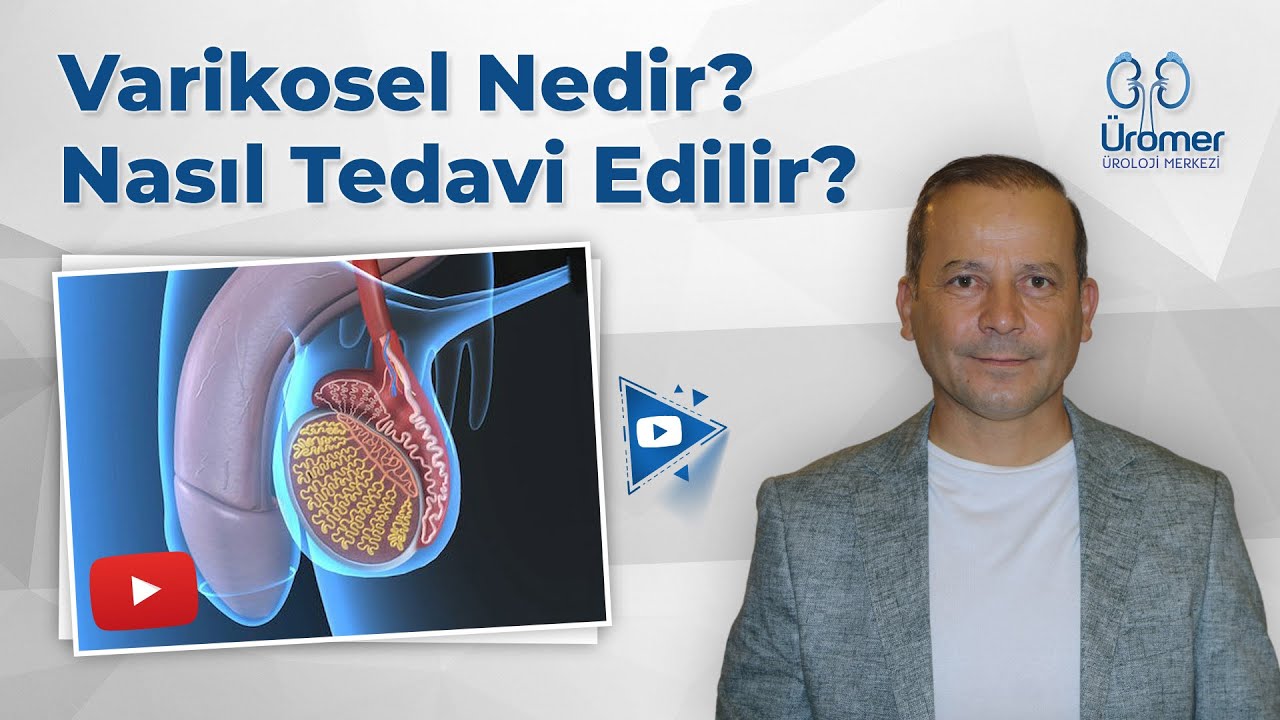 Varikosel Nedir? Nasıl Tedavi Edilir? | Prof. Dr. Abdullah Armağan ...
