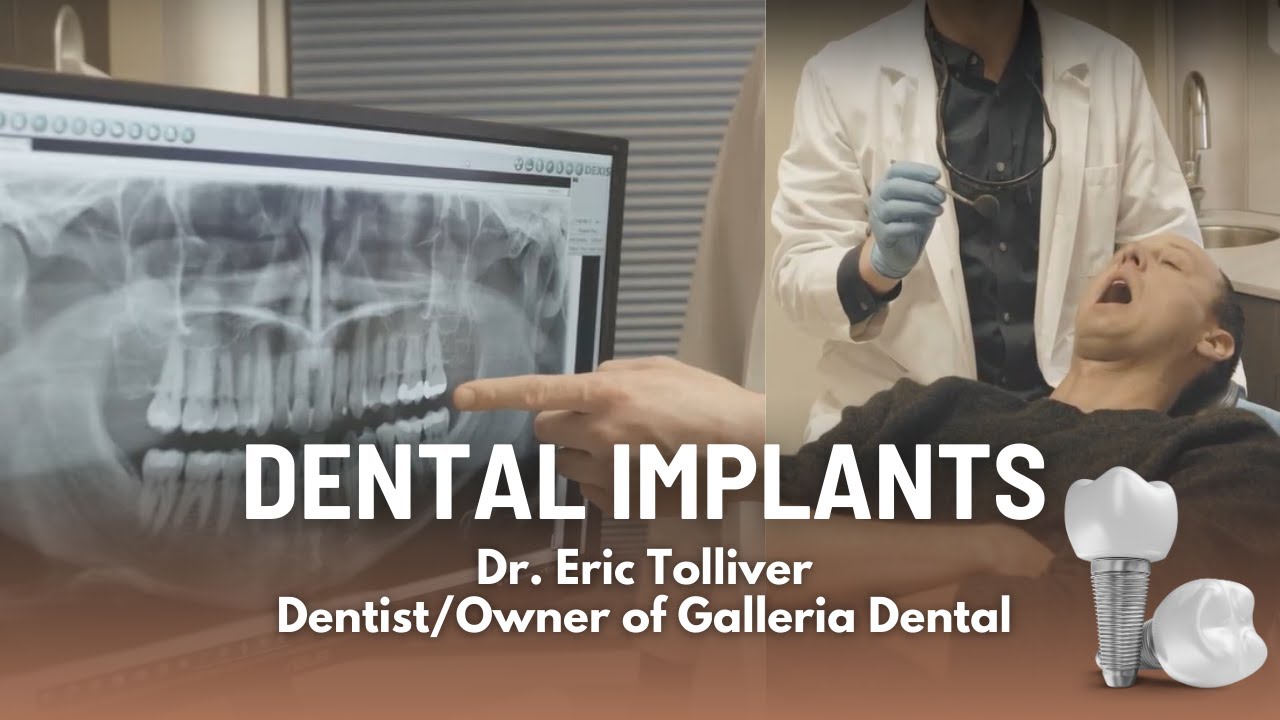 Dr. Eric Tolliver Explains the Importance of Dental Implants | Why ...