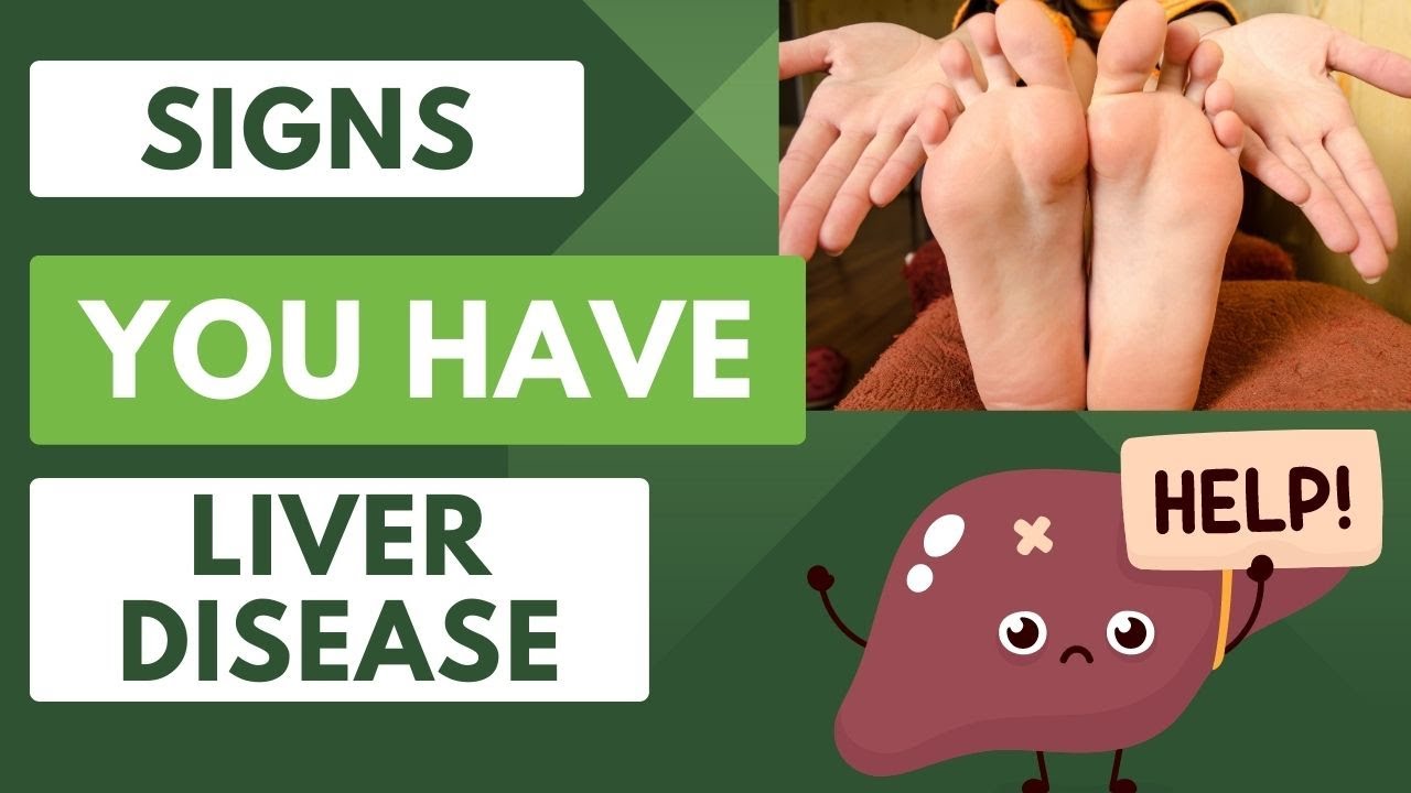 Your Hands and Feet Speak Louder Than Words: Understanding Liver ...