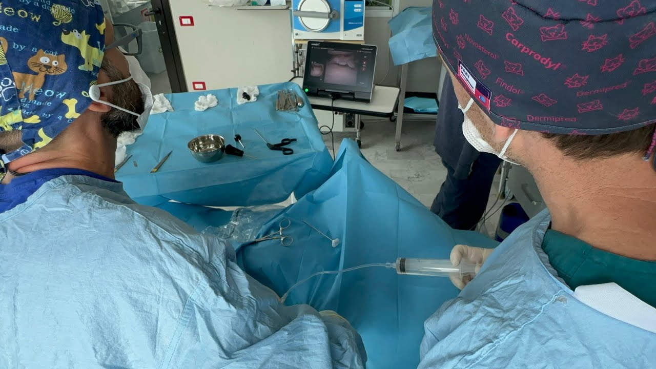 c94 splenectomia - YouTube