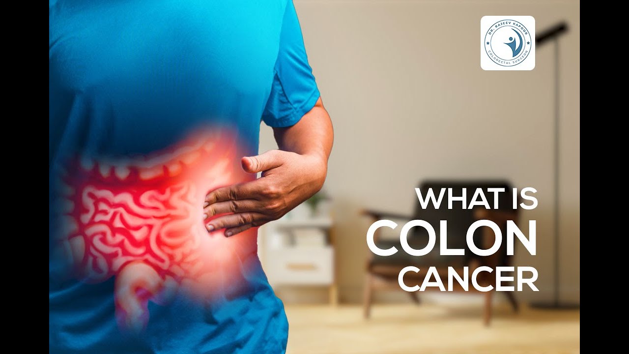 All About Colon Cancer by Dr. Rajeev Kapoor || Colorectal Surgeon in ...