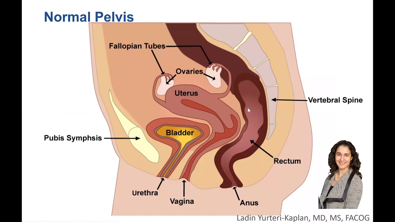 What Is Uterine Prolapse And How Is It Treated YouTube