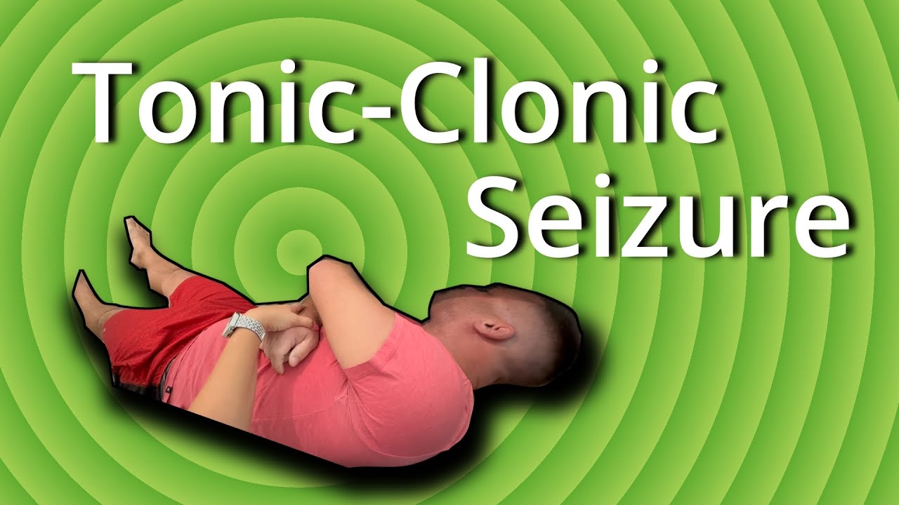 Tonic-Clonic Seizure - YouTube