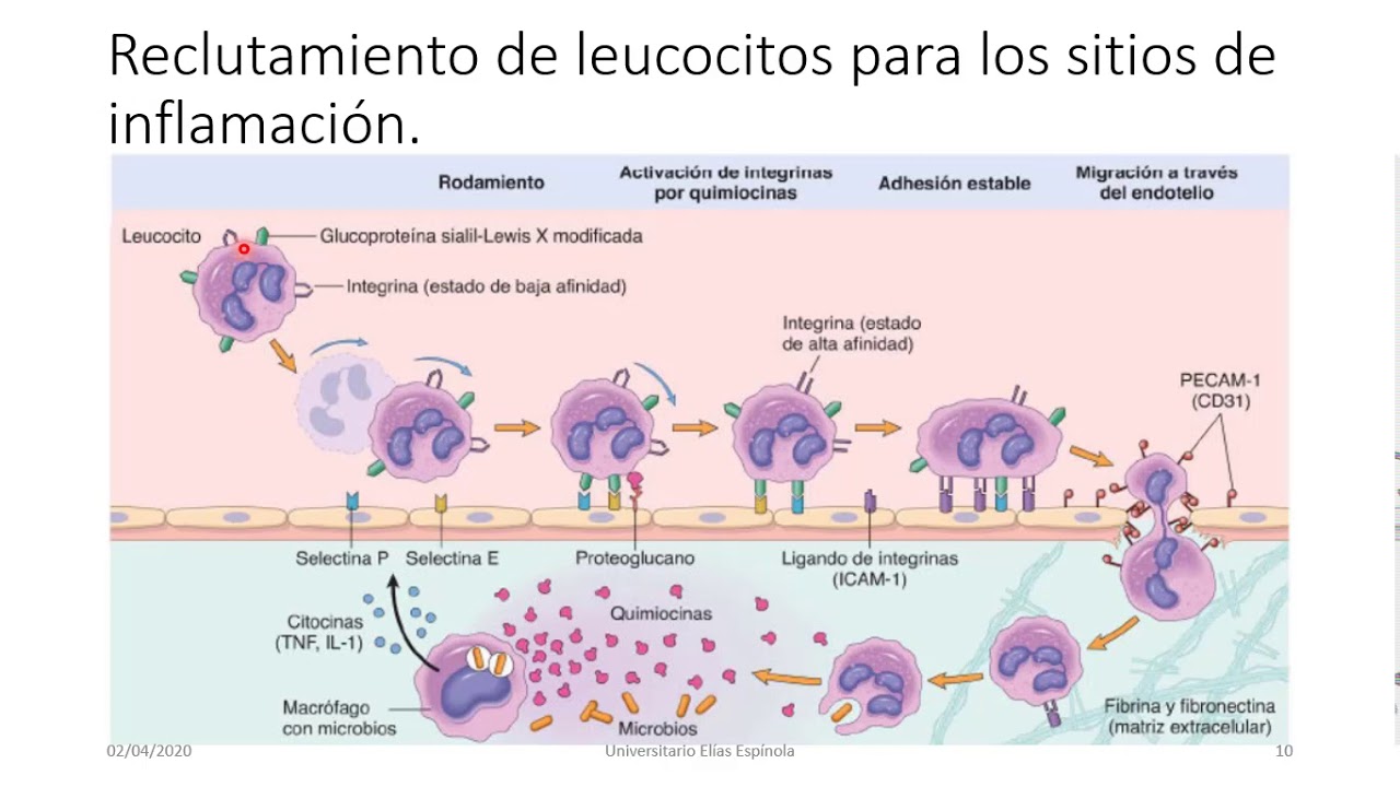 Inflamación aguda y crónica - Anatomía Patológica - YouTube