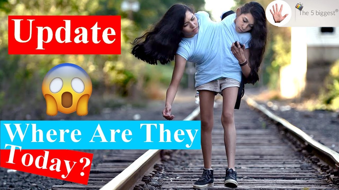 Conjoined Twins Carmen and Lupita's : 2 legs and 4 arms! Update Video ...