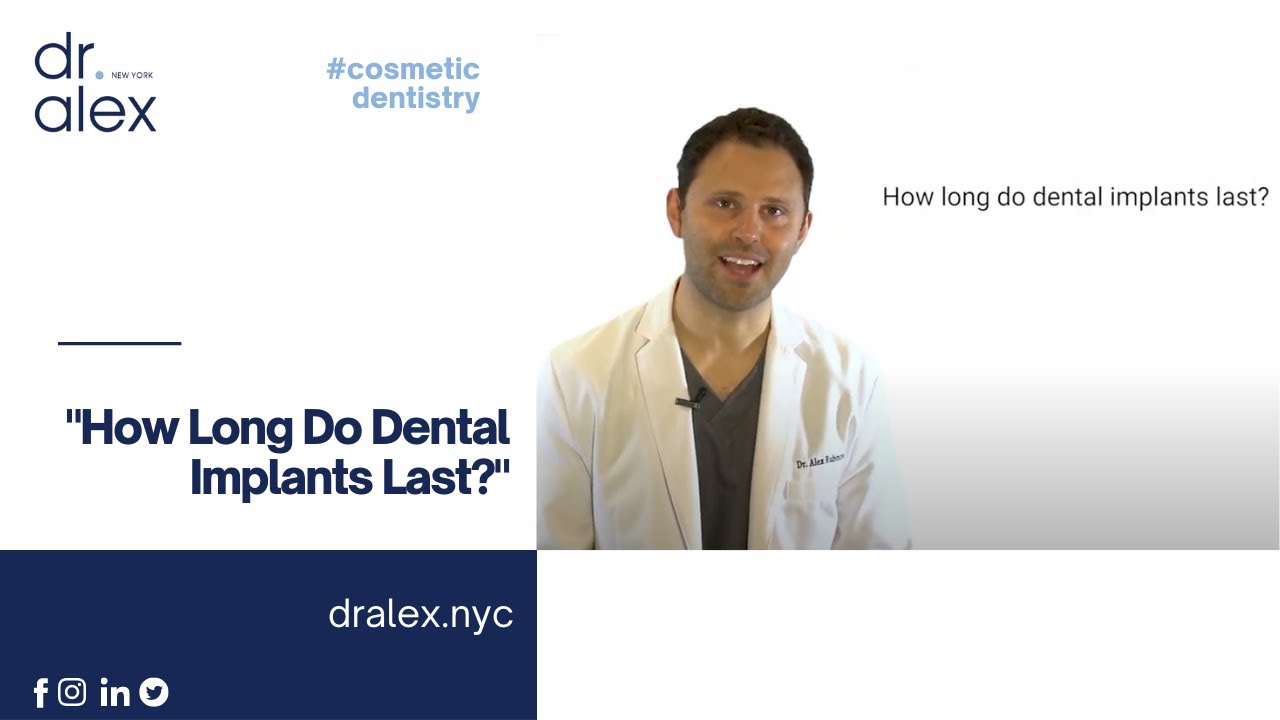 How Long Do Dental Implants Last - Dr. Alex Rubinov - Cosmetic Dentist ...