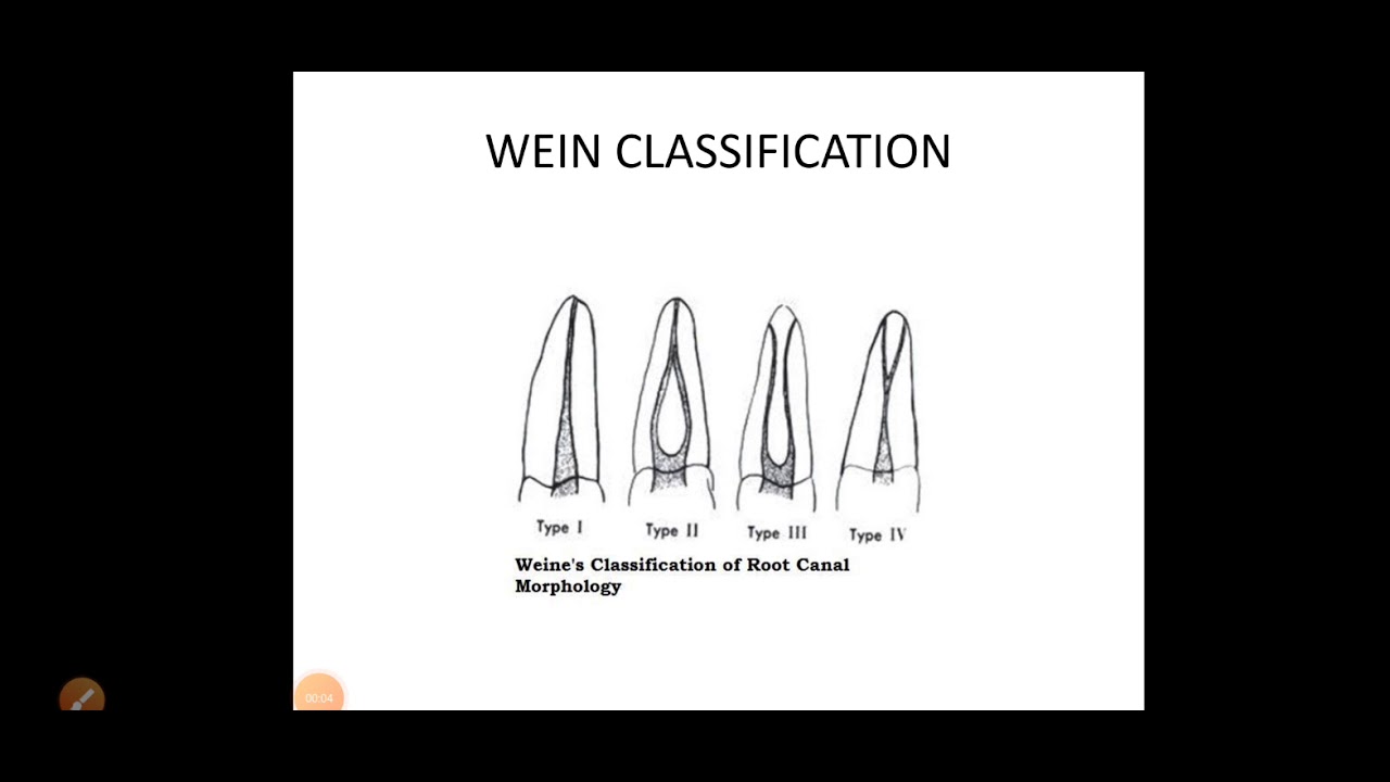 wein classification - YouTube
