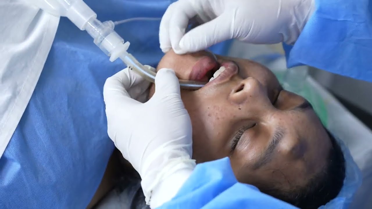 Doctor Women to Anesthesia Intubation for small Hemangioma Surgery ...