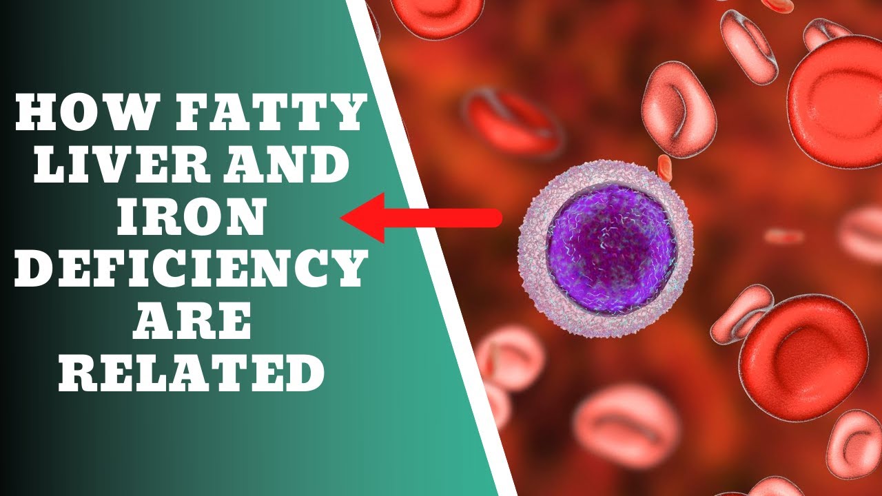 How Fatty Liver And Iron Deficiency Are Related | Alarming Low Iron ...
