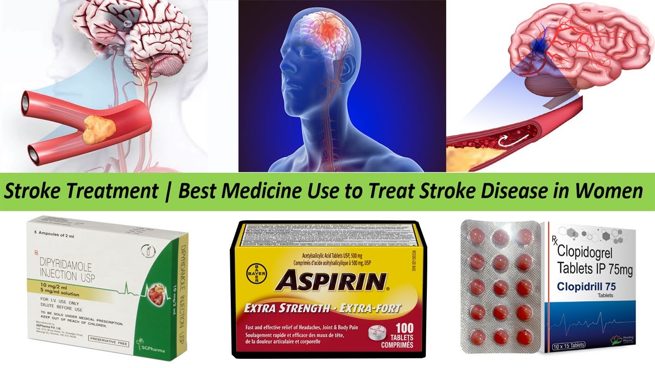Stroke Treatment | Best Medicine Use to Treat Stroke Disease in Women ...