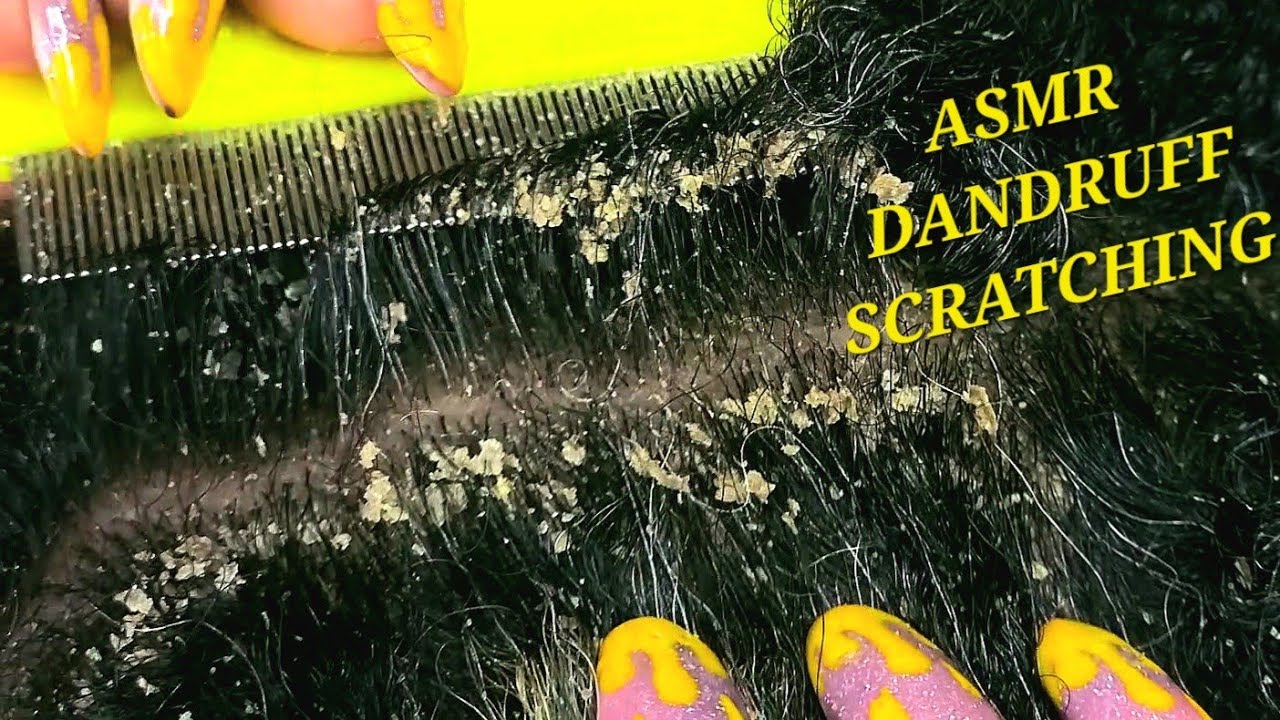 ASMR Dandruff Scratching | Part 1 | 083 - YouTube
