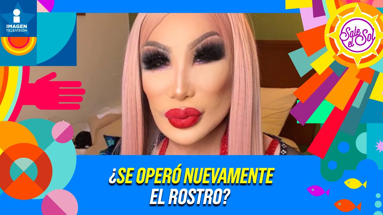 ¿Lyn May se operó nuevamente el rostro? | Sale el Sol - YouTube