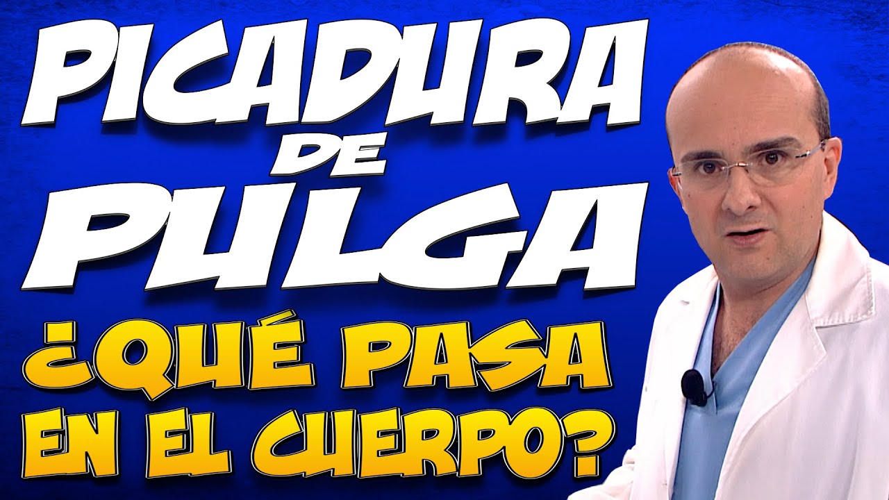 PICADURA DE PULGA - ¿Qué pasa dentro del cuerpo de las personas que la ...